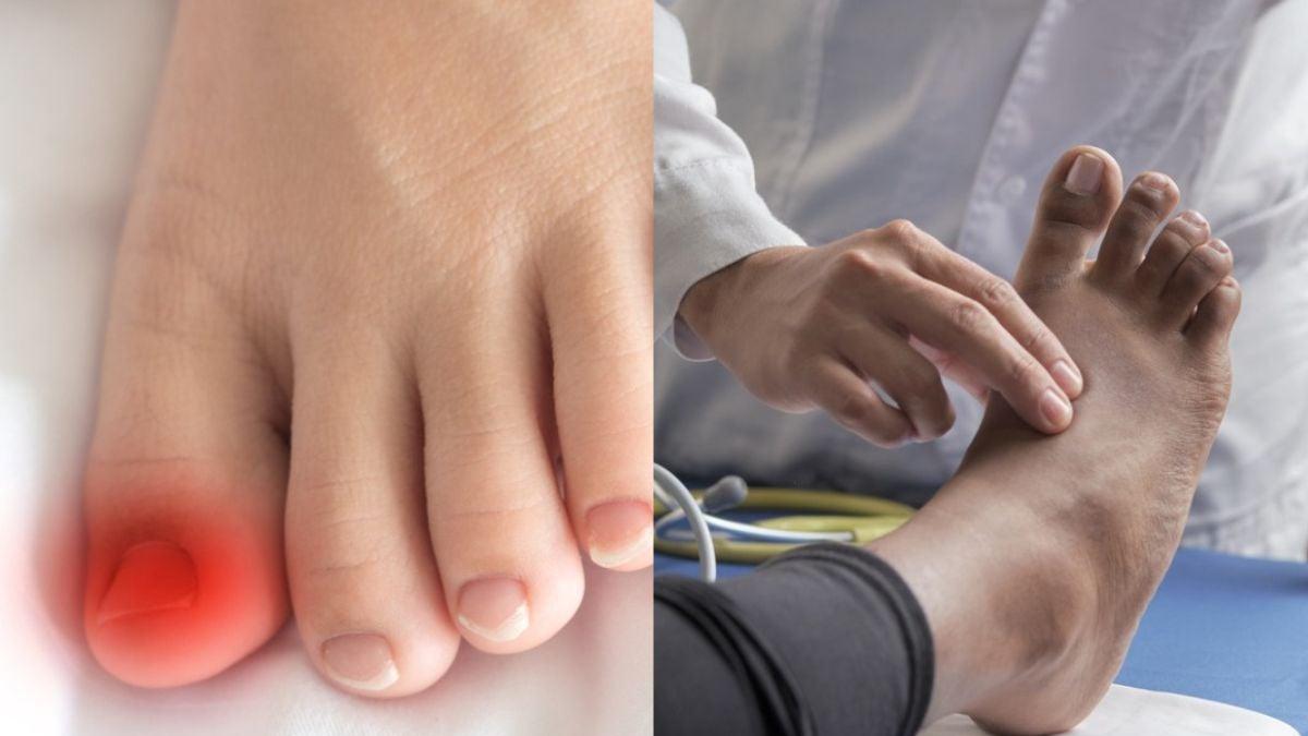 4 afecciones que podría revelarte un dolor en el dedo pulgar del pie