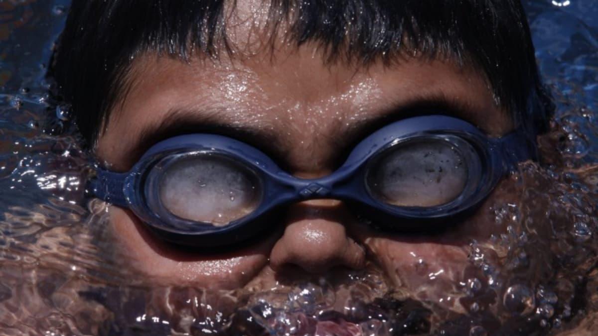 Un niño 'cachetón' y 'piernudo' no es sano; podría padecer diabetes ...